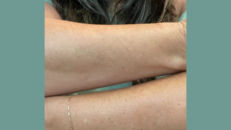 I Tried The Kate Walsh-Approved Crepe Erase Skin Line, Here’s What I Think